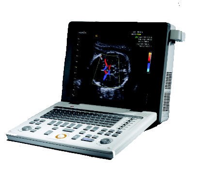 Máy siêu âm 3D Doppler màu Medison SonoAce R3 | VINACOMM